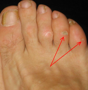 FOOT PROBLEMS - Wicklow